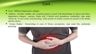 Post mortem finding | PPT