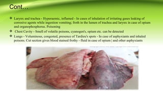 Post mortem finding | PPT