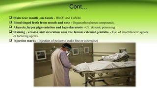 Post mortem finding | PPT