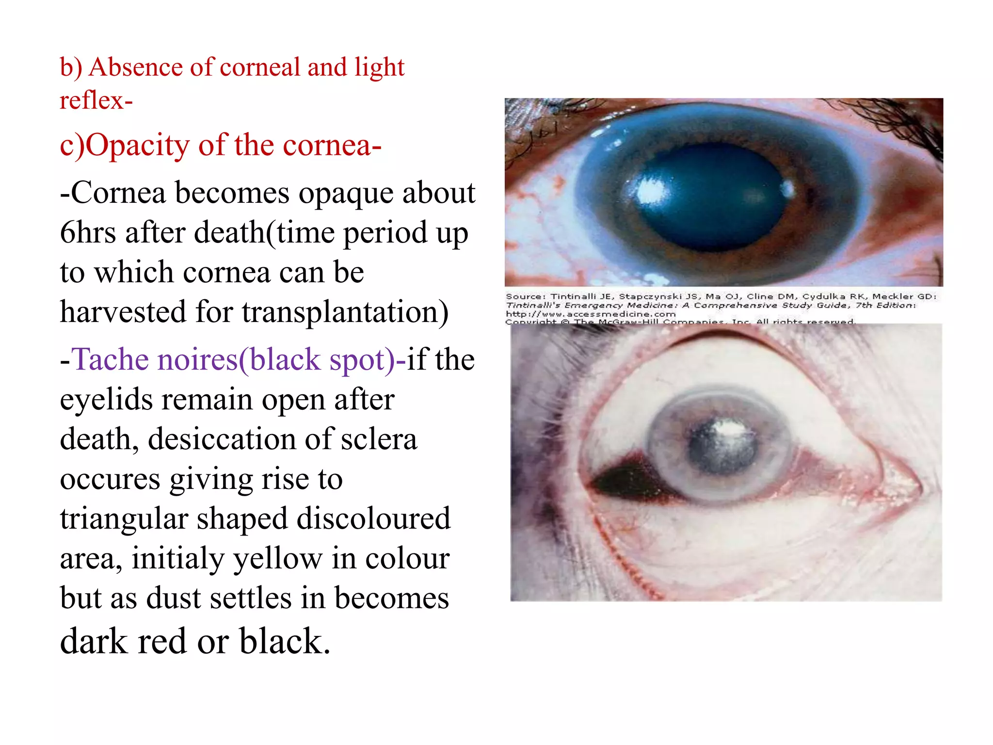 Post mortem interval | PPTX