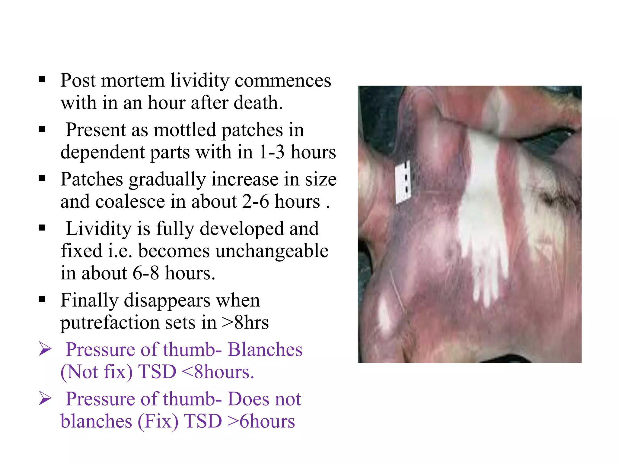 Post mortem interval | PPTX