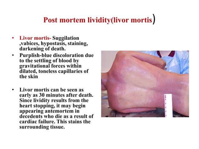 Post mortem interval | PPTX | First Aid | Injuries