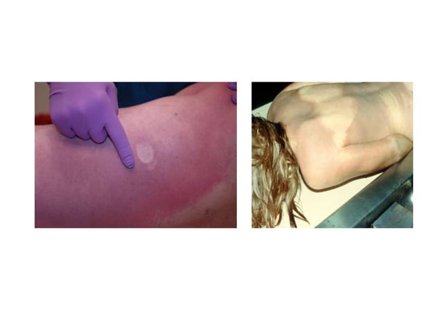 Post mortem interval | PPTX | First Aid | Injuries