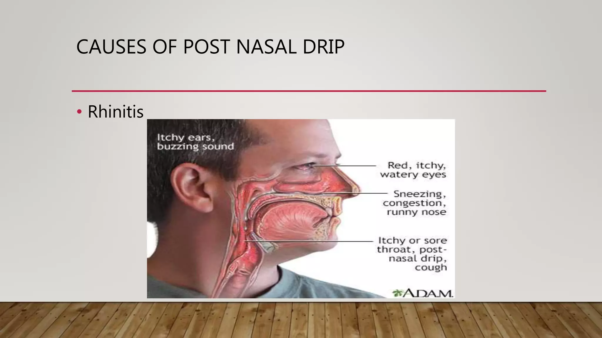 Post Nasal Drip PPTX