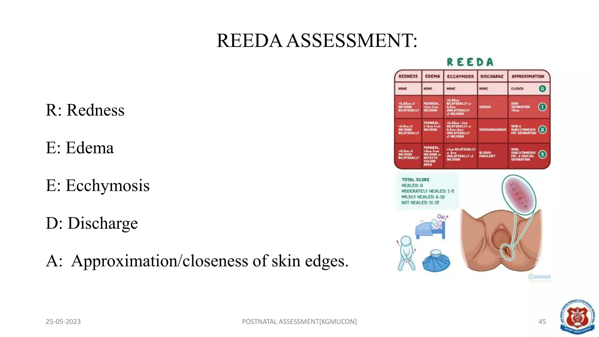 postnatal assessment.pptx