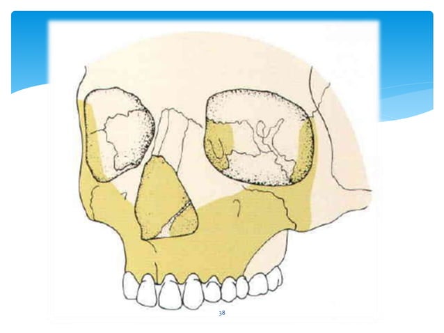 Post natal development of cranial base, maxilla and mandible | PPTX