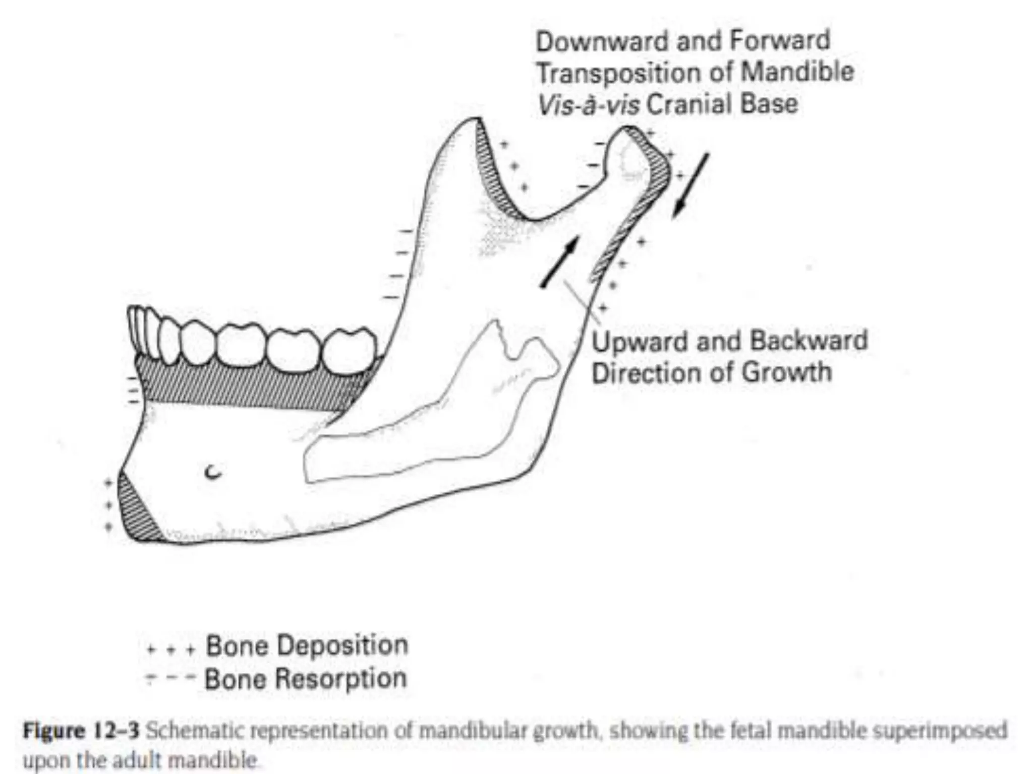 POSTNATAL DEVELOPMENT OF MANDIBLE.pptx