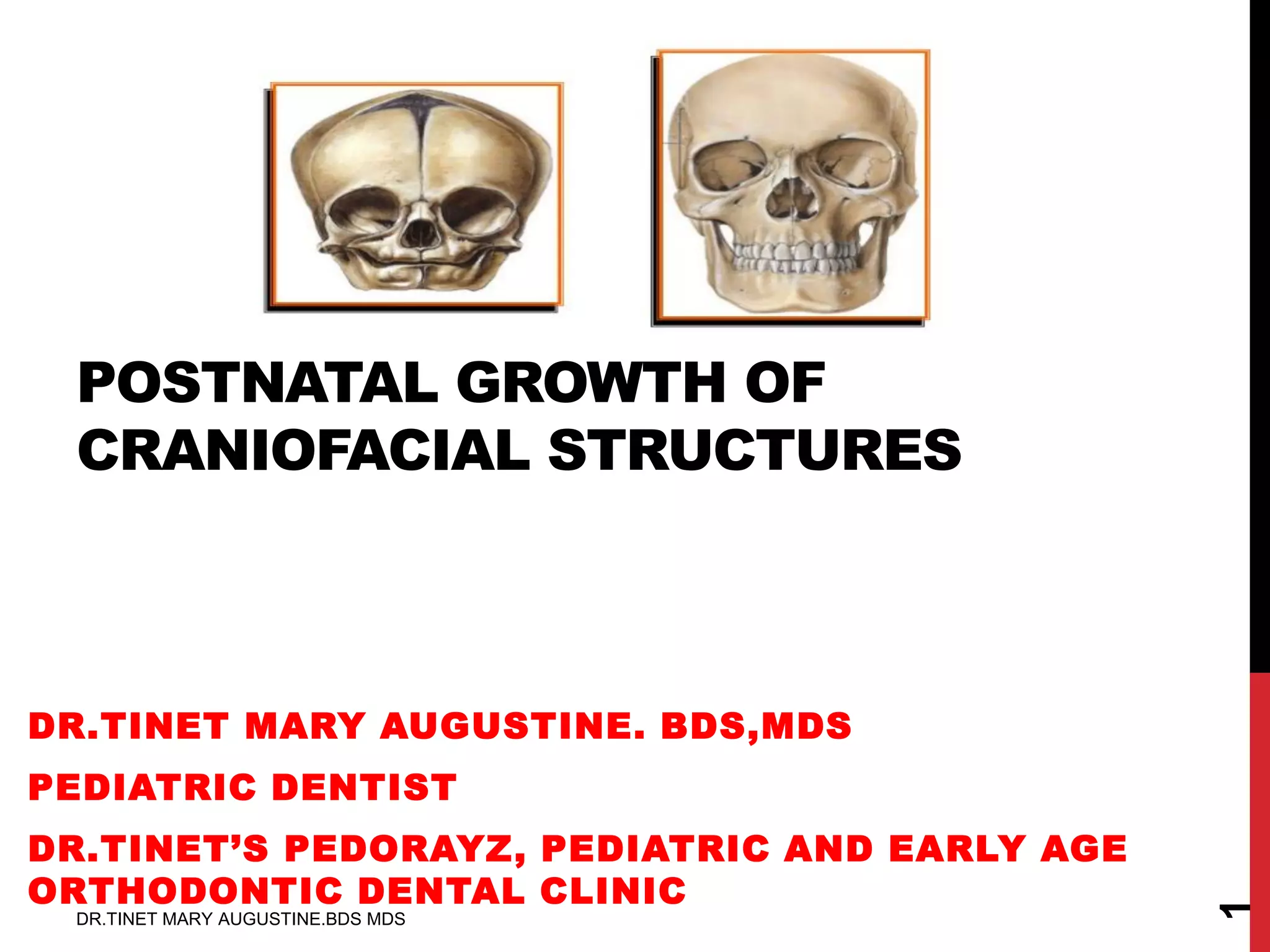 Postnatal growth of cranio facial structures | PPT