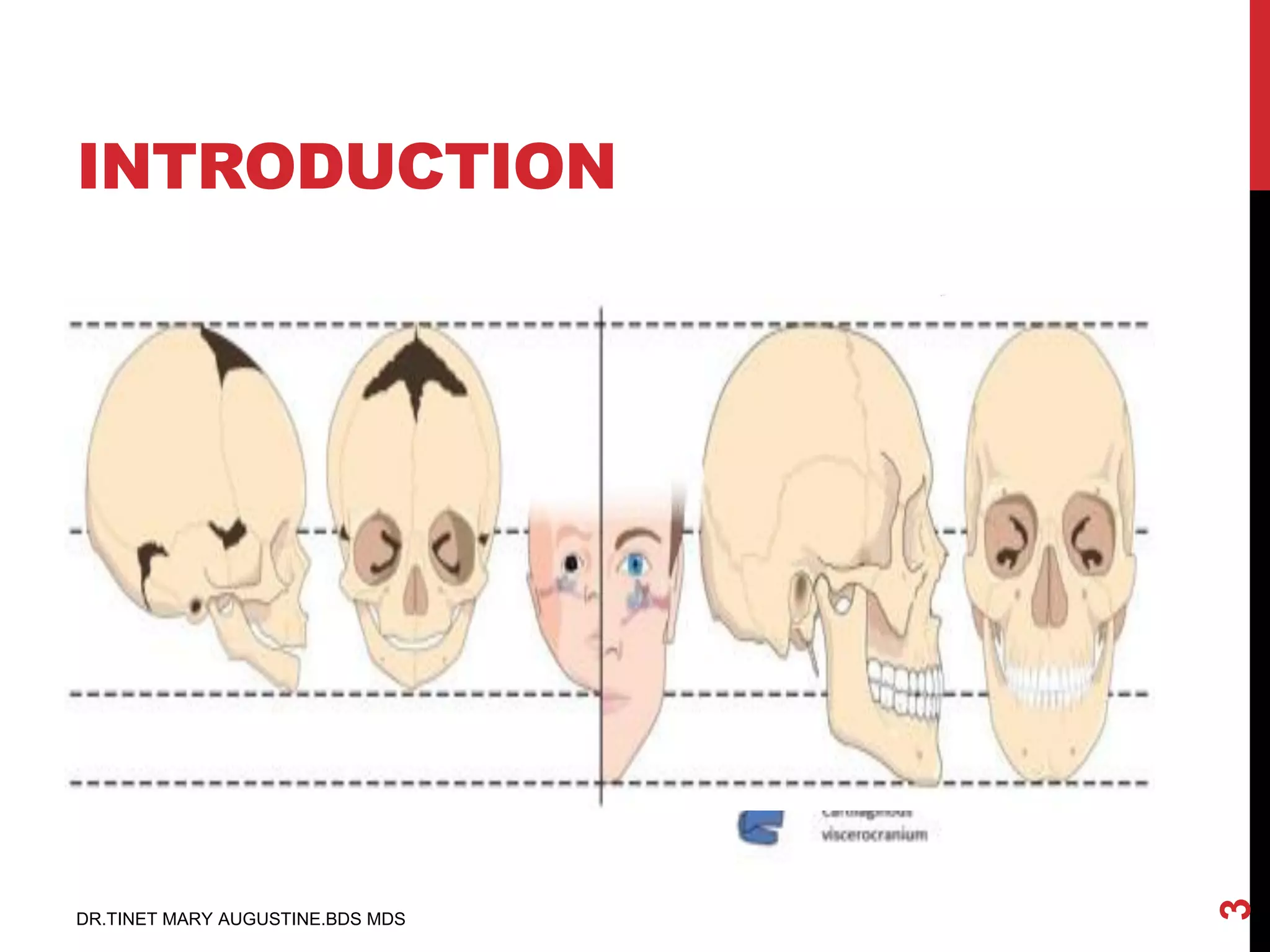 Postnatal growth of cranio facial structures | PPT