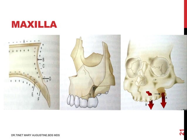 Postnatal growth of cranio facial structures | PPT