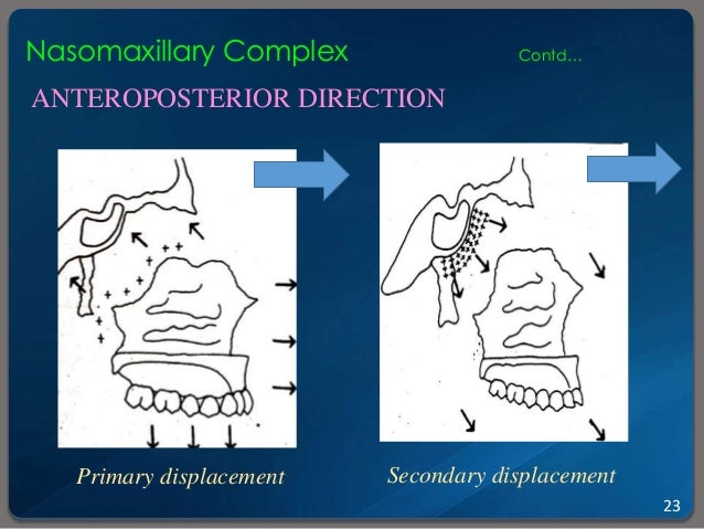 Postnatal growth of face