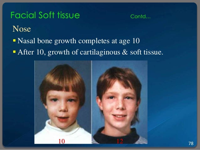 Postnatal growth of face