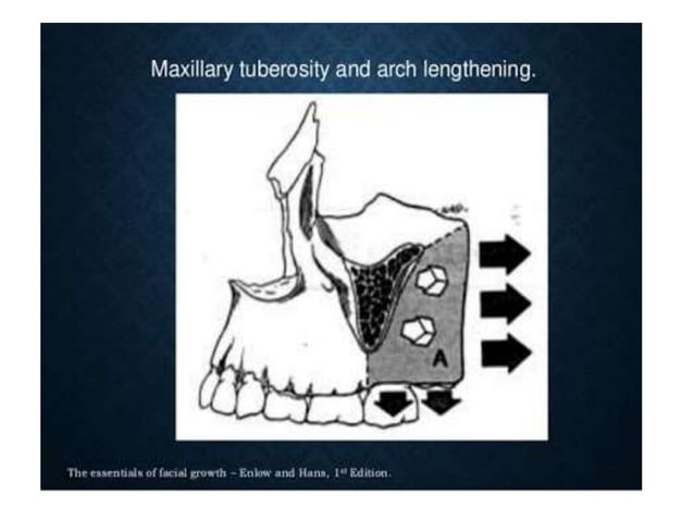 Postnatal growth of maxilla | PPTX