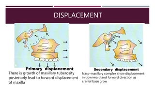 Post natal growth of maxilla and mandible | PPT