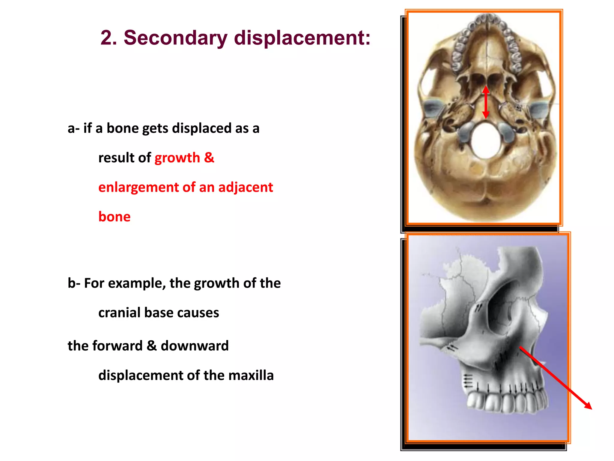 Postnatal growth of the skull and jaws _ Dr. Nabil Al-Zubair | PDF
