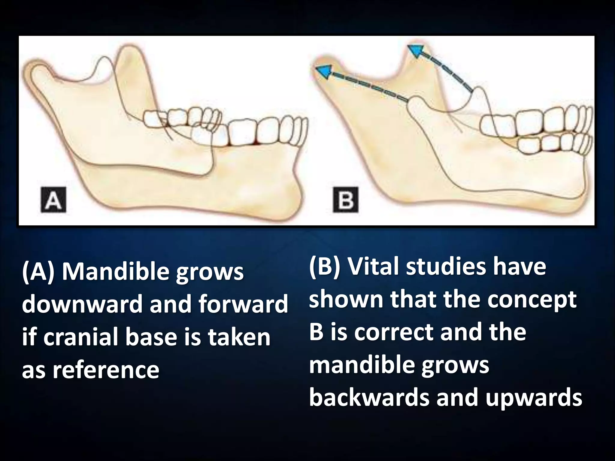 Postnatal growth of mandible | PPT