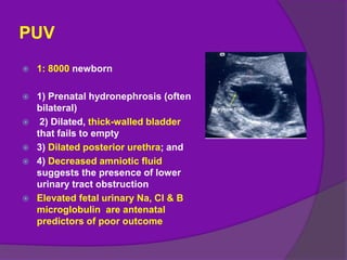 Postnatal mangement of anh (2) | PPTX