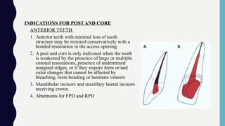 post n core. in prosthodontics and dental science | PPTX