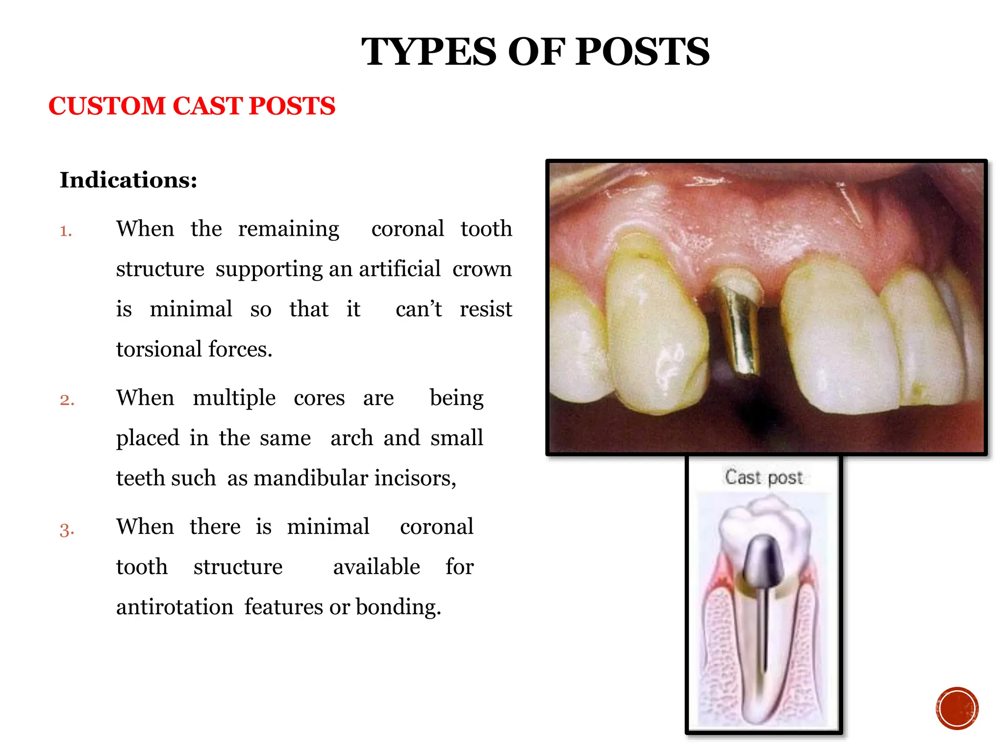 PostNdCore classification types n new trends | PPTX