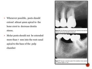 PostNdCore classification types n new trends | PPTX