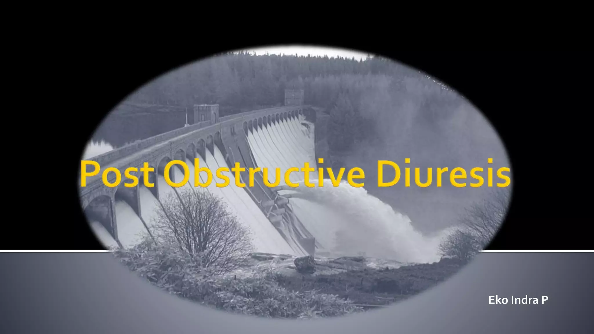 Post obstructive diuresis | PPTX
