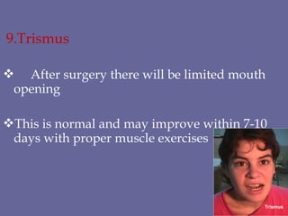 Post operative care after Tooth Extraction | PPT