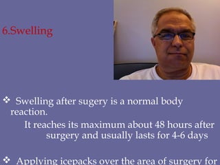 Post operative care after Tooth Extraction | PPT