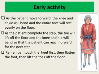 Post operative ambulatory exercises | PPTX