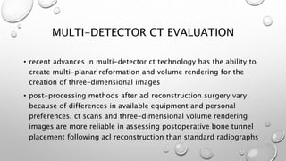 Post operative assessment of acl reconstruction | PPTX