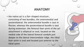 Post operative assessment of acl reconstruction | PPT