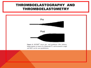 Postoperative bleeding & guidelines for transfusion | PPT