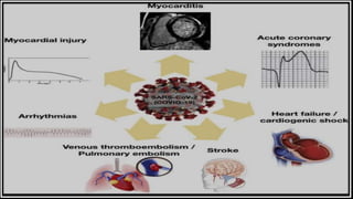 Postoperative cardiovascular complications | PPTX