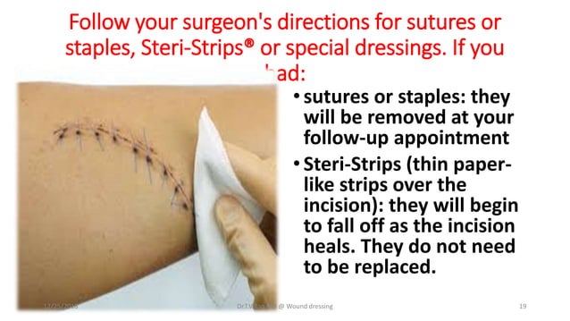 BIOSAFETY IN SURGICAL DRESSING ROOMS How to care for an incision, and ...