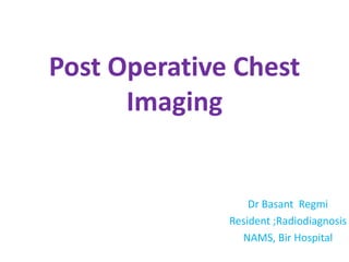 Post operative chest imaging | PPTX