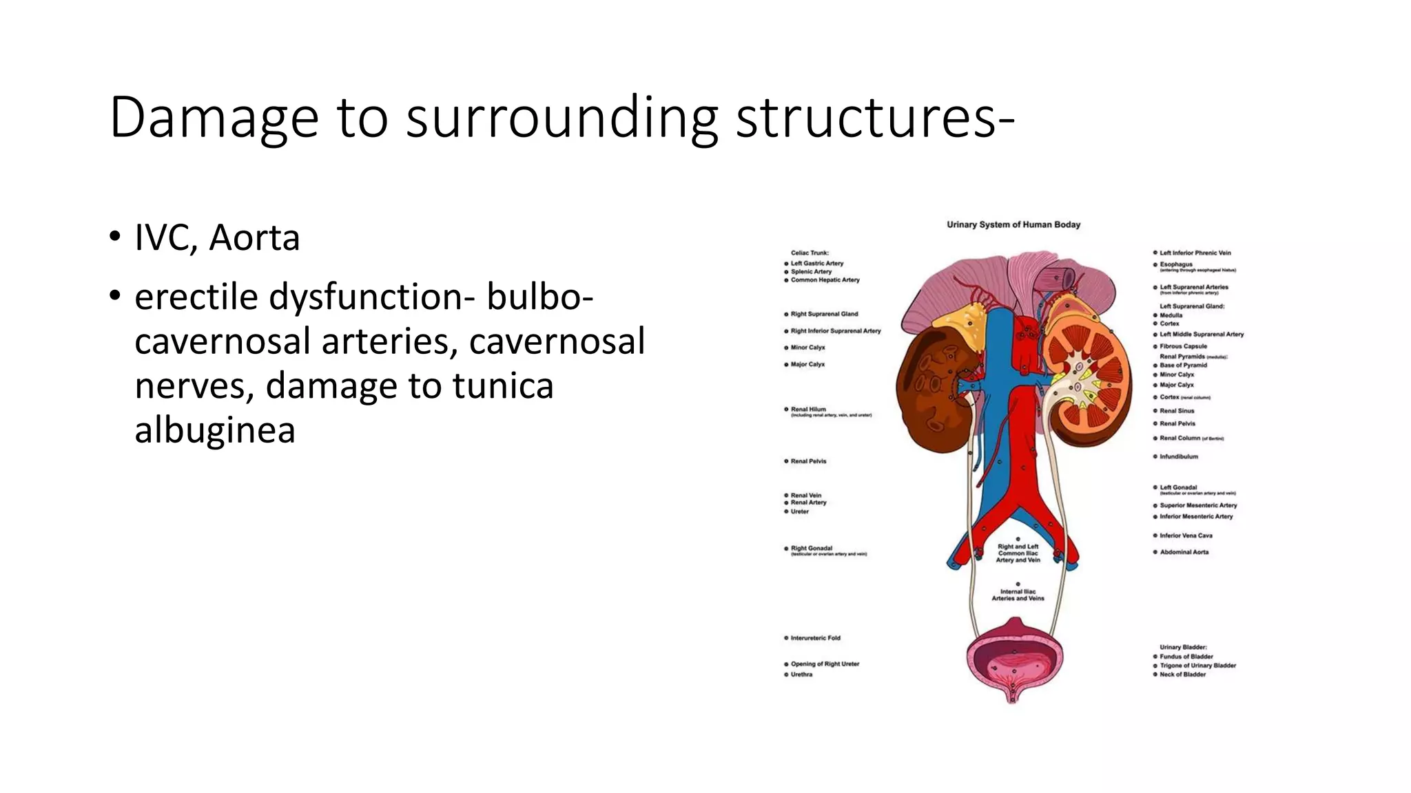 Post operative complications in urology.pptx