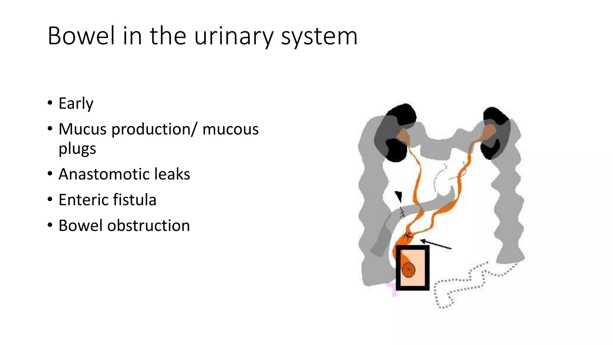 Post operative complications in urology.pptx