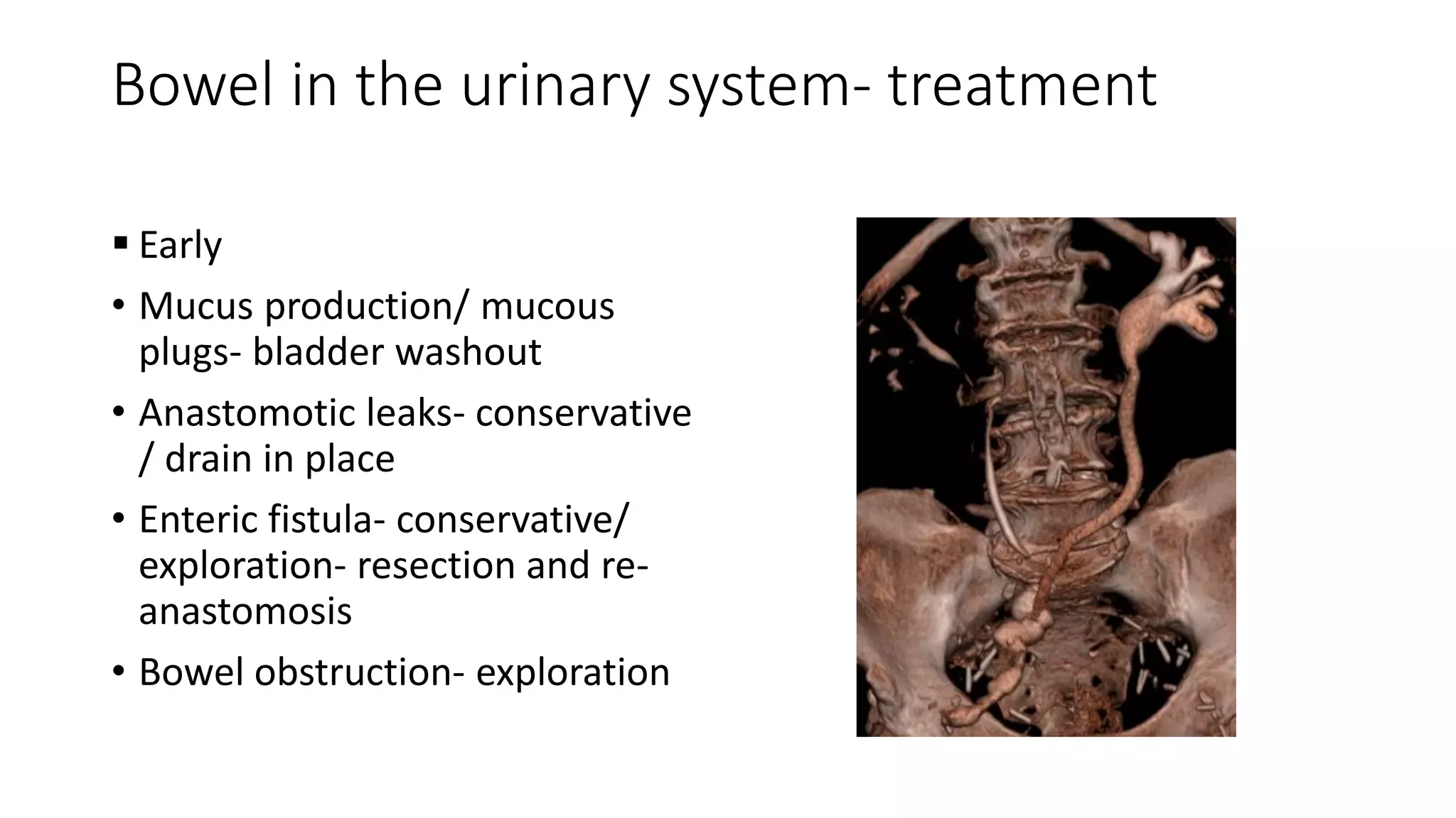 Post operative complications in urology.pptx