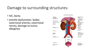 Post operative complications in urology.pptx