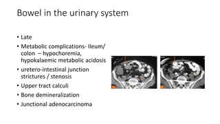 Post operative complications in urology.pptx