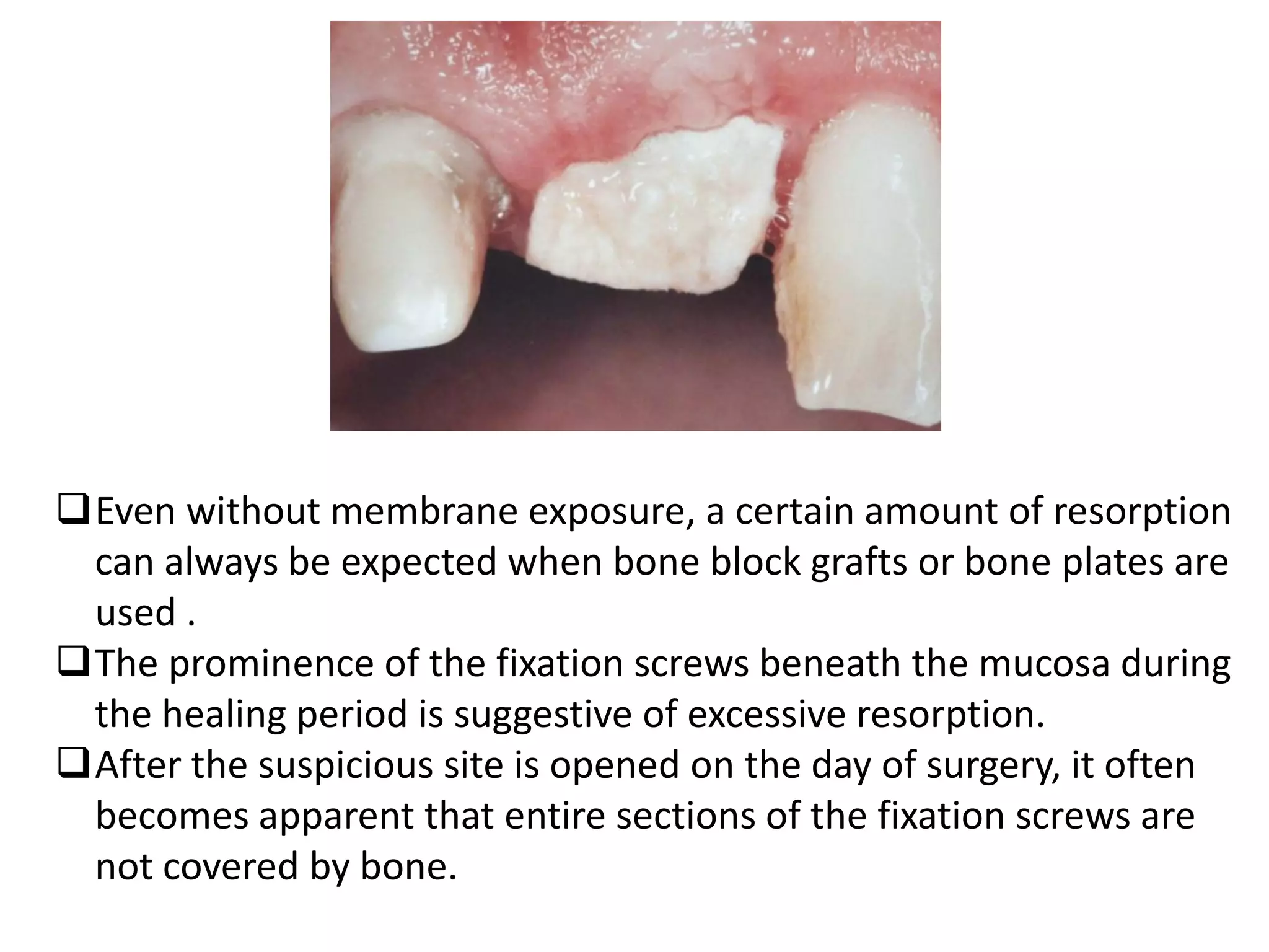 Post operative complications of periodontal surgery | PDF