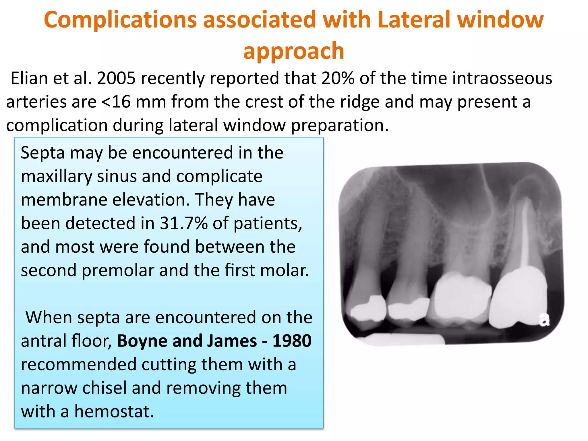 Post operative complications of periodontal surgery | PDF