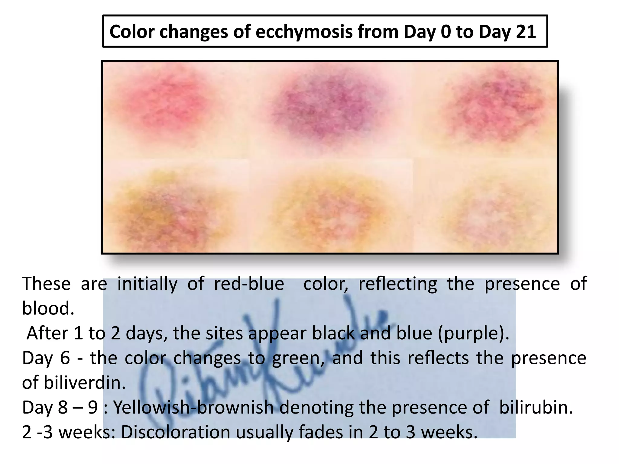 Post operative complications of periodontal surgery | PDF
