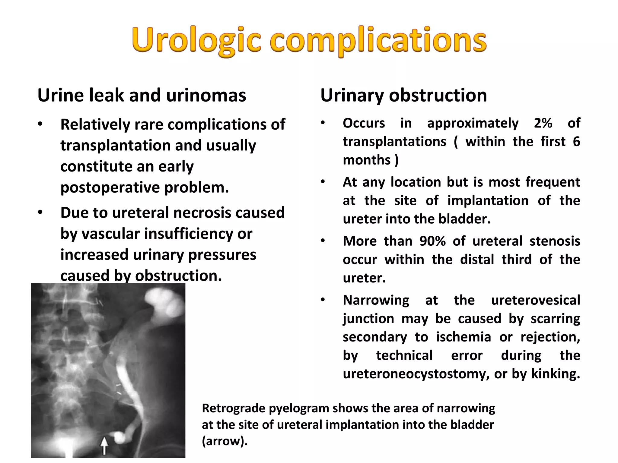 Post operative complications of renal transplant | PPT