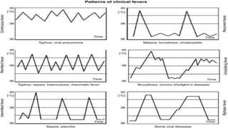 Post operative fever | PPTX