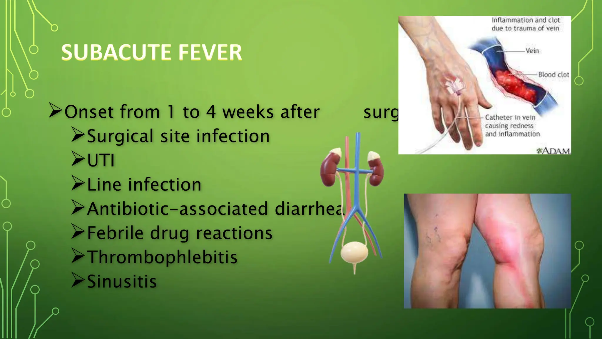 POST OPERATIVE FEVER.pptx