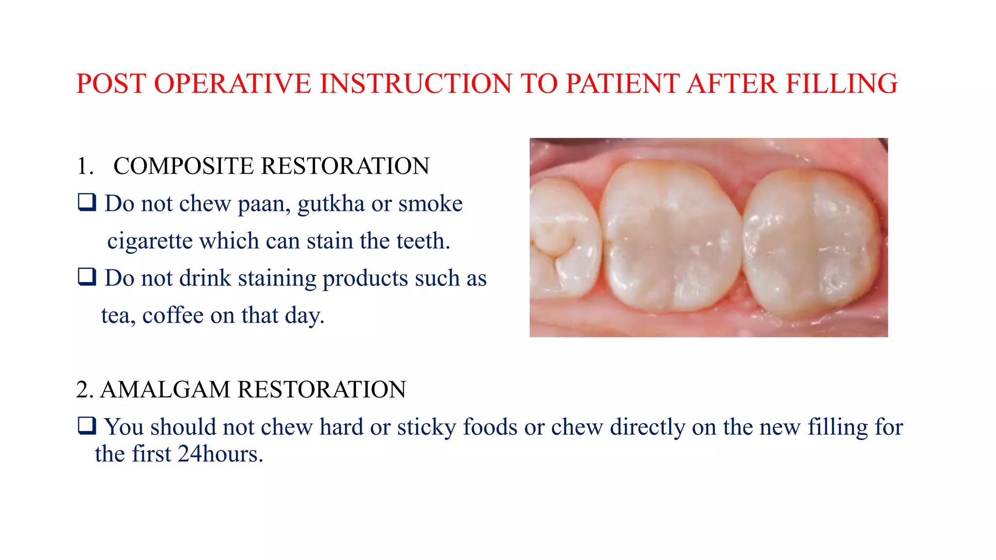 Post operative instructions | PPTX