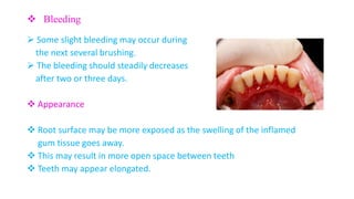 Post operative instructions | PPTX