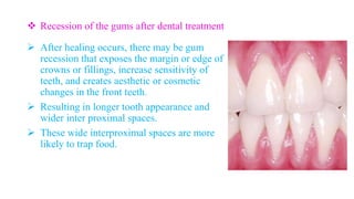 Post operative instructions | PPTX