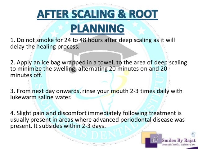 Post Operative Instructions Deep Scaling Ashok Vihar Delhi