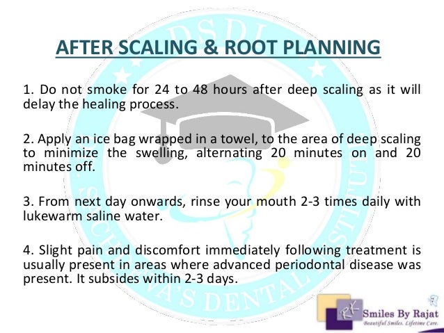 Post Operative Instructions to Patient after Deep Scaling